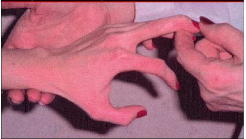 Accurate Education – Neck Pain